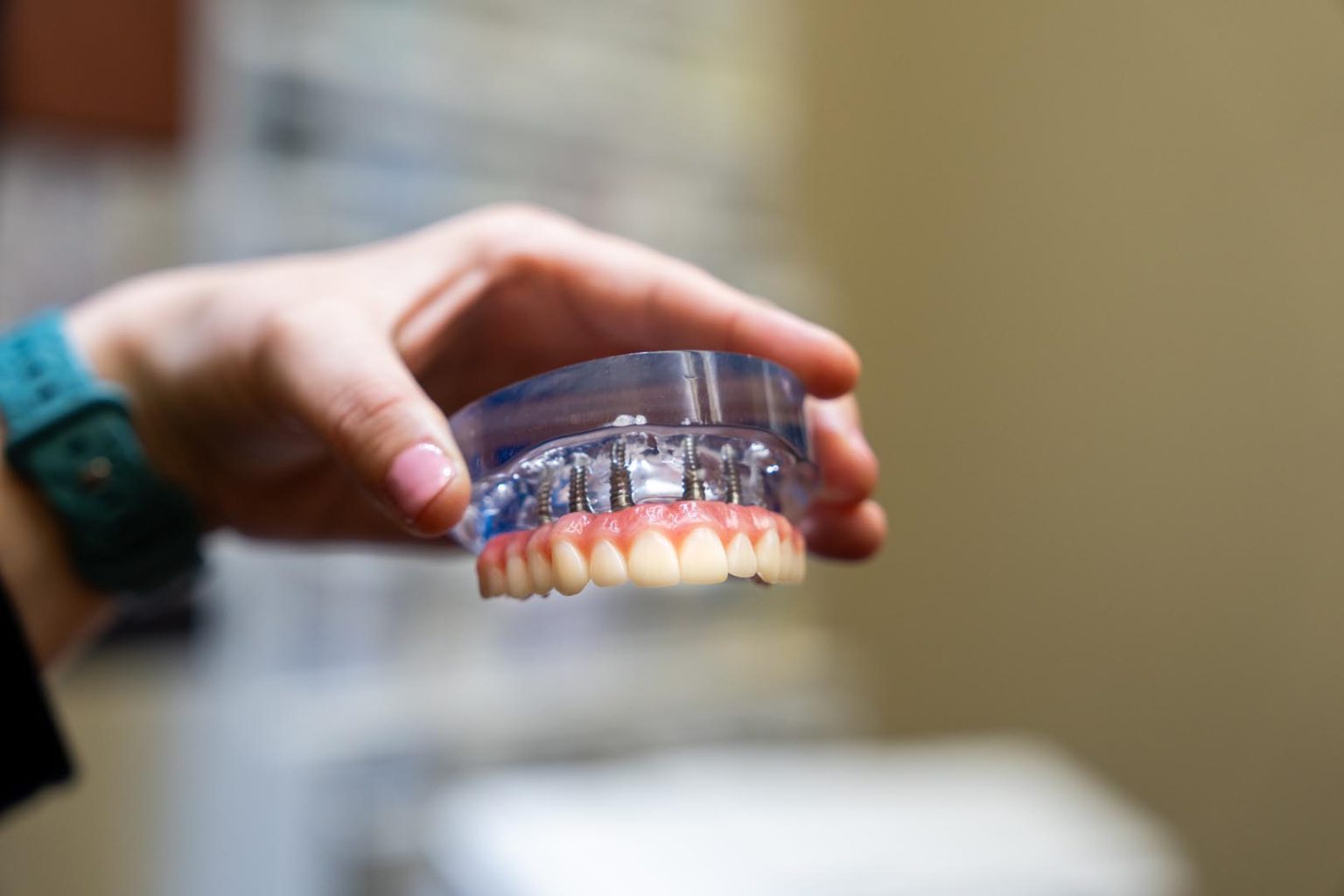 Same Day Teeth: Get New Teeth in a Day | WM Dental Care